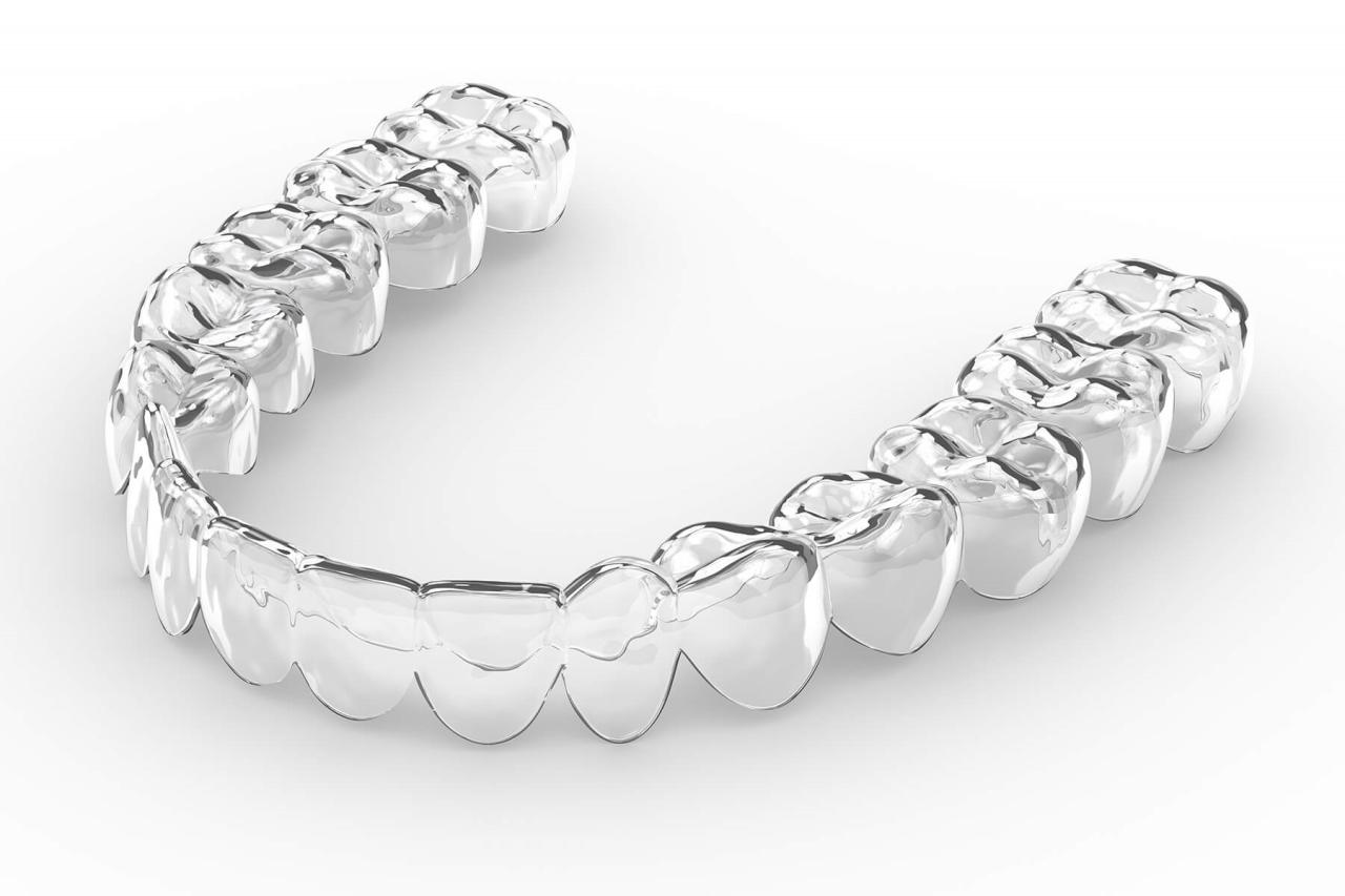 Mouth Guards vs Retainers vs Aligners: What's the Difference? - ITS Dental